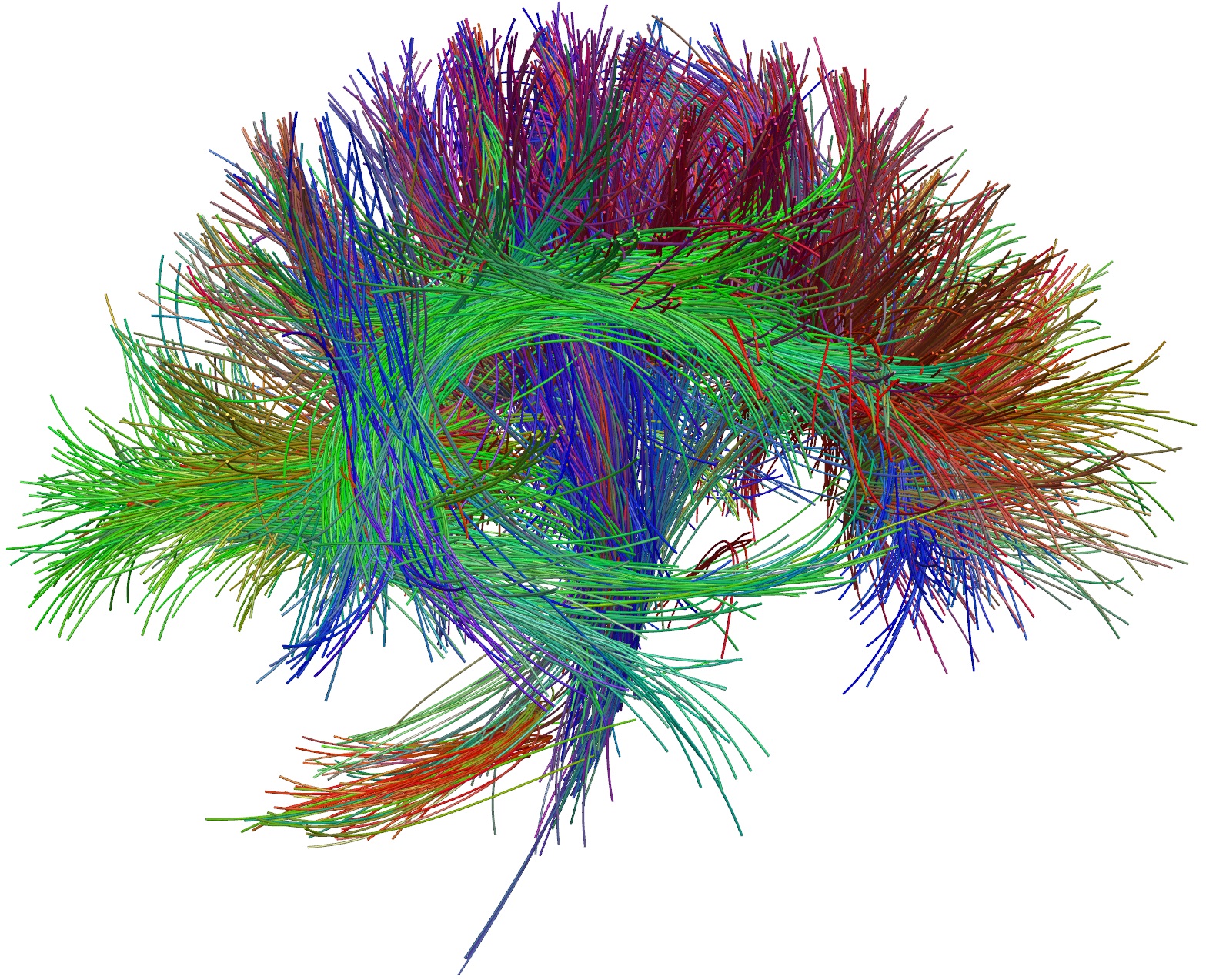 Diffusion Mri Q Ball Csa Odf And Hough Tractography Open Neuroscience